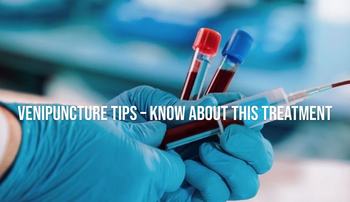 Venipuncture Tips - Know About This Treatment